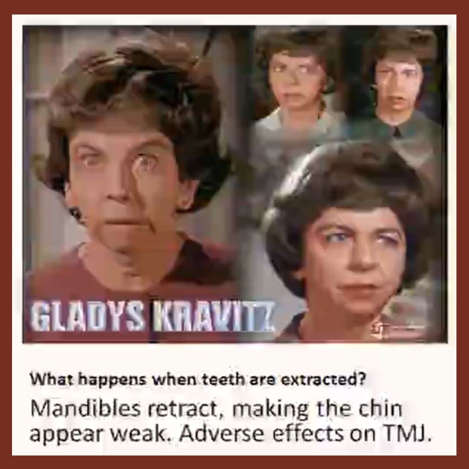 Know how to build bone density in your face. It’s important too ...